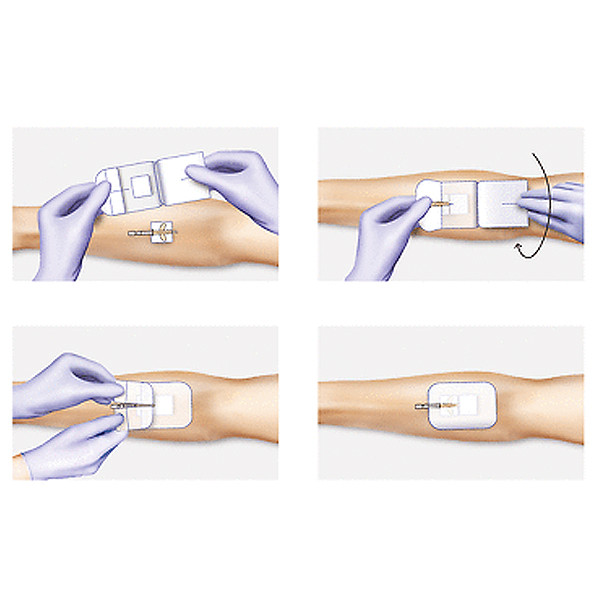 Cosmopor® I.V. Kanülenfixierverband | ProPraxis TCM & Praxisbedarf ...